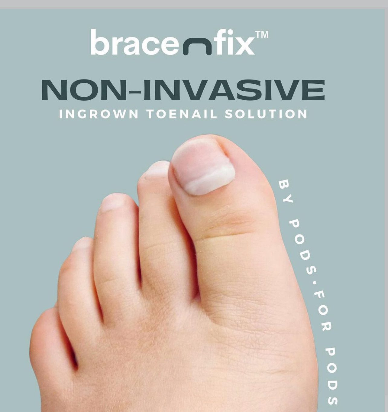 Bracenfix™ – Innovative Ingrown Toenail Treatment - Brisbane Foot Clinic